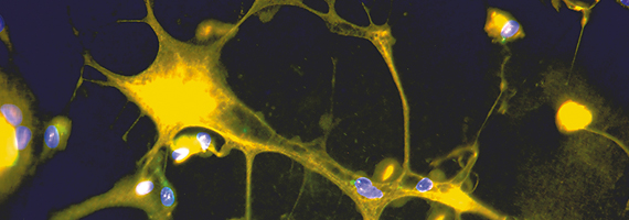 Rapid isolation of untouched neurons